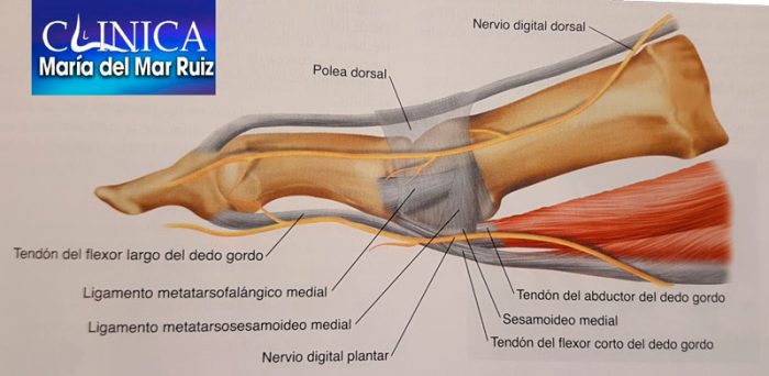 Sesamoiditis y Fractura de los sesamoideos